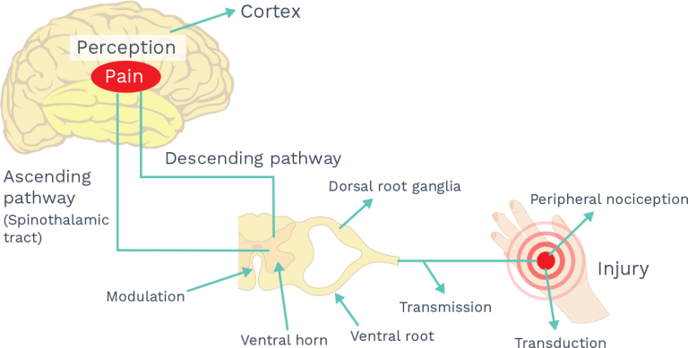 Understanding Pain: What is Nociceptive Pain? - Square One Active Recovery