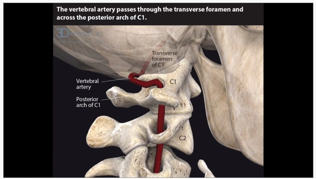 The dangers of a Y-strap neck adjustment - Square One Active Recovery